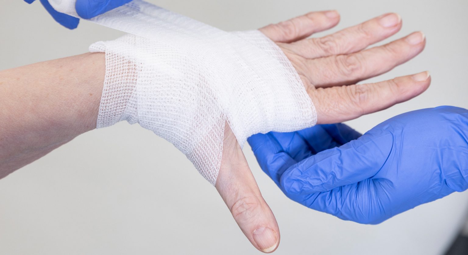 Springfinger - Die Handchirurgie