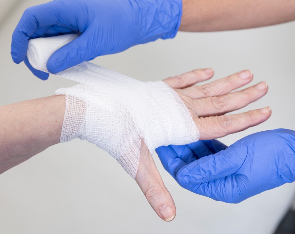 Tendovaginitis stenosans de Quervain, - Die Handchirurgie