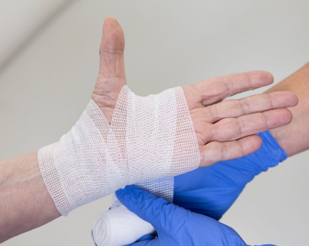 Tendovaginitis stenosans de Quervain, - Die Handchirurgie